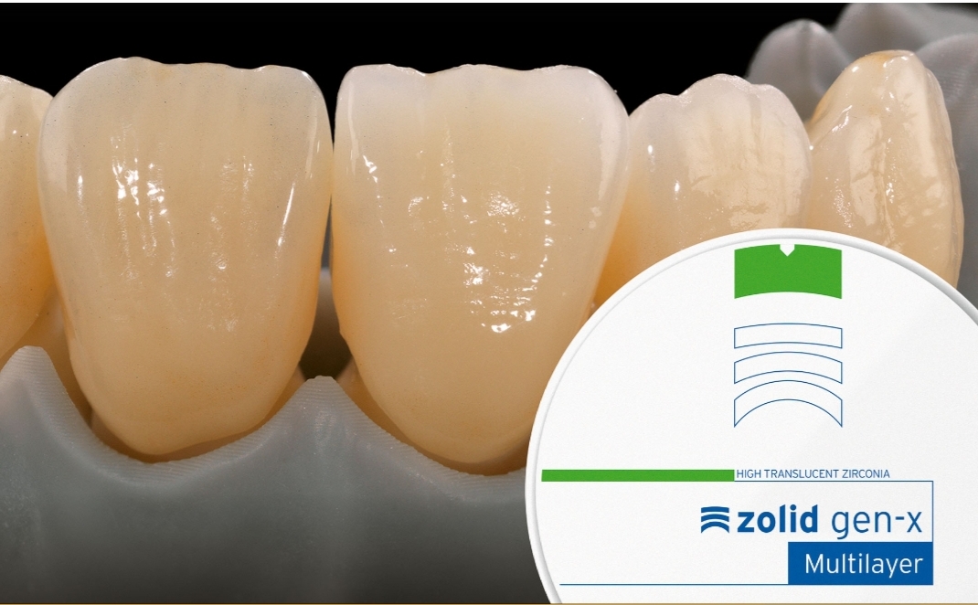 2020 : GEN X UNIVERSAL ZIRCONIA DISC | Karetek Digital